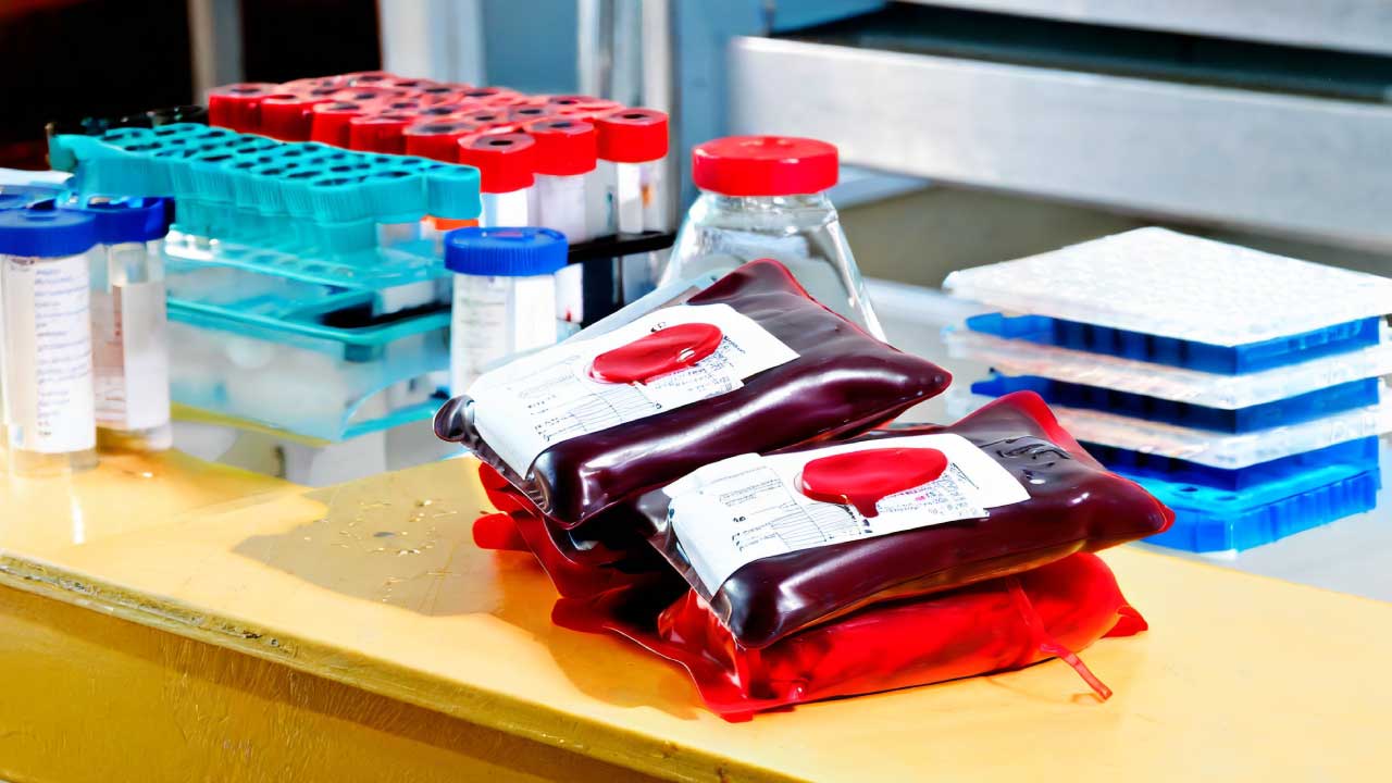 Components of Donated Blood Products: Types & Indications