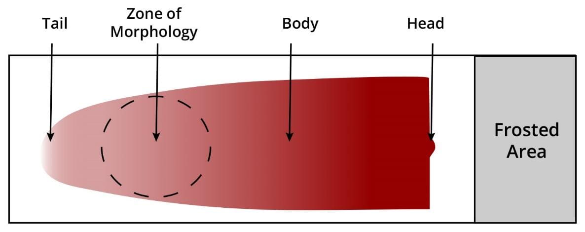 Preparation of Peripheral Blood Smears | My Hematology