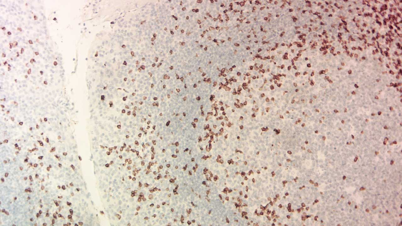 Immunohistochemistry (IHC) Stain: Purpose, Principle & Protocol
