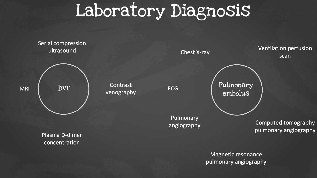 Venous Thrombosis (VTE) | My Hematology