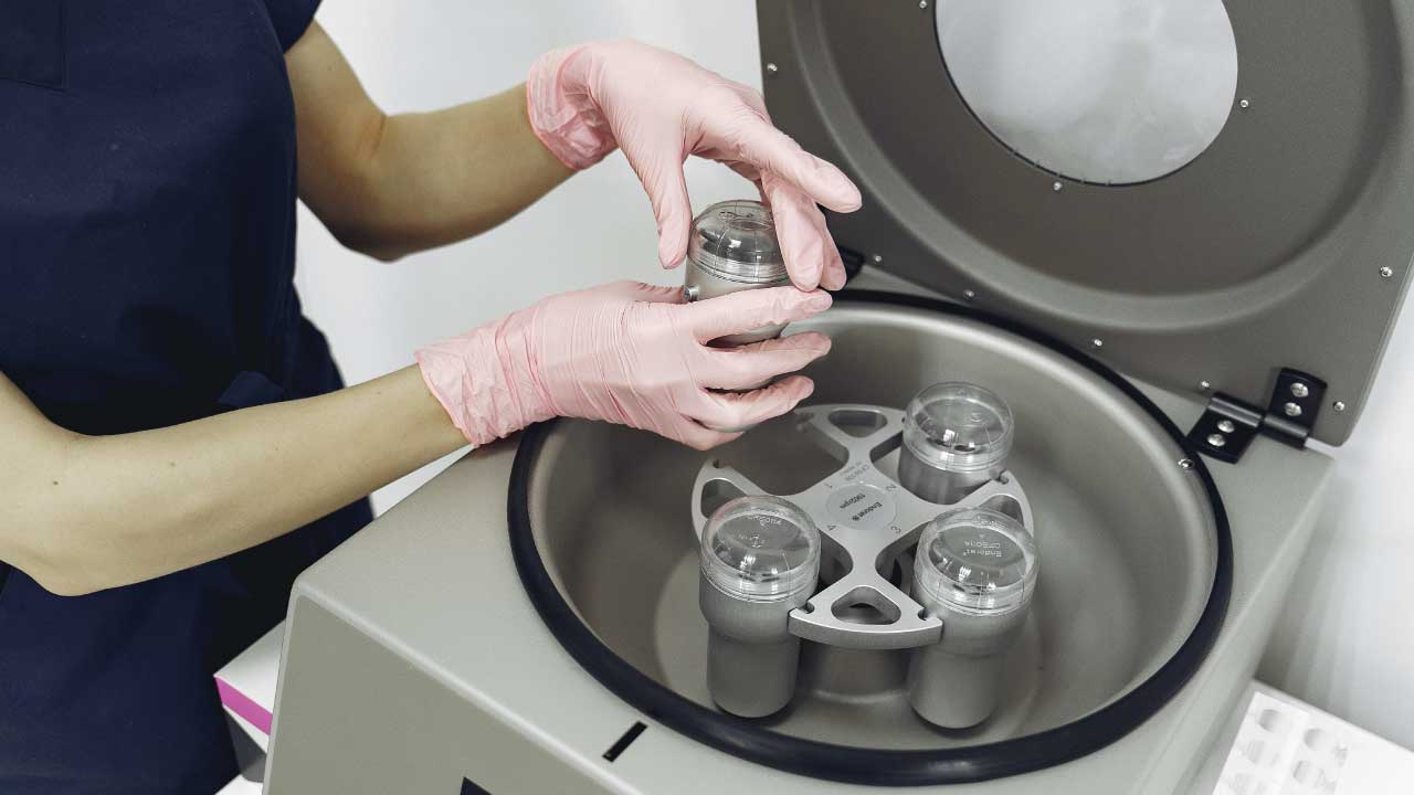 Manual APTT Mixing Studies: Principle, Protocol & Interpretation