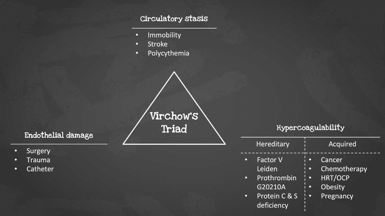Venous Thrombosis (VTE) | My Hematology