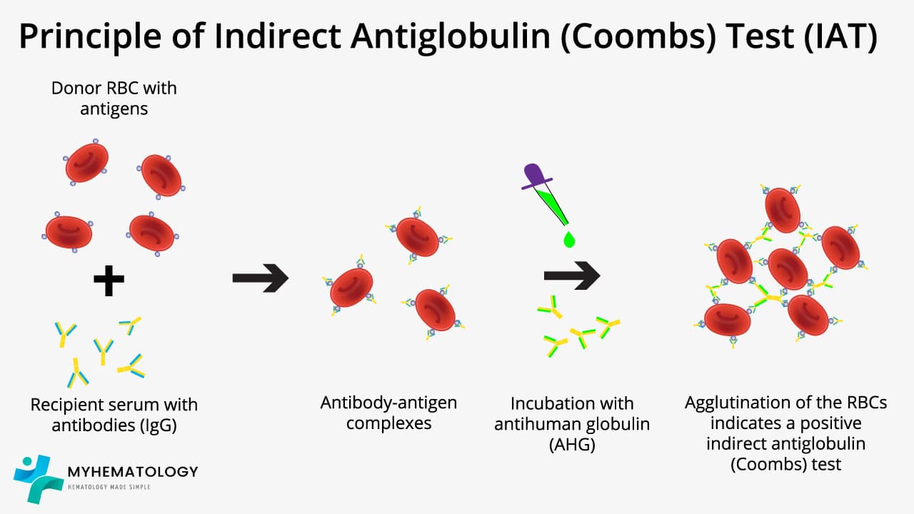 Indirect Antiglobulin (Coombs) Test (IAT): Principle & Procedure