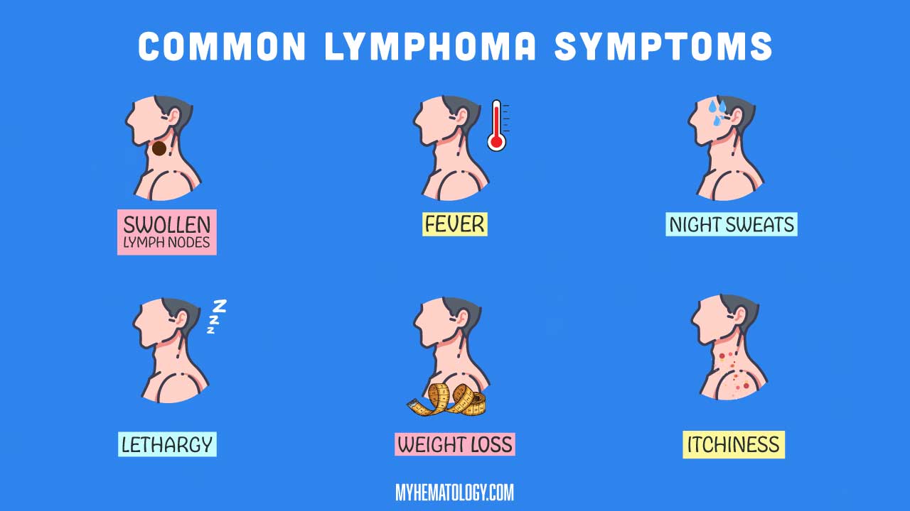 Lymphoma Overview: Symptoms, Diagnosis & Treatment