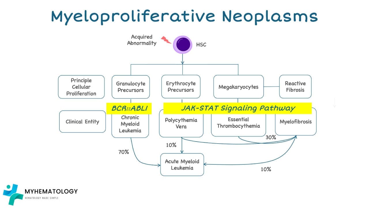 Myeloproliferative Neoplasms - MPNs: Symptoms, Types & Diagnosis