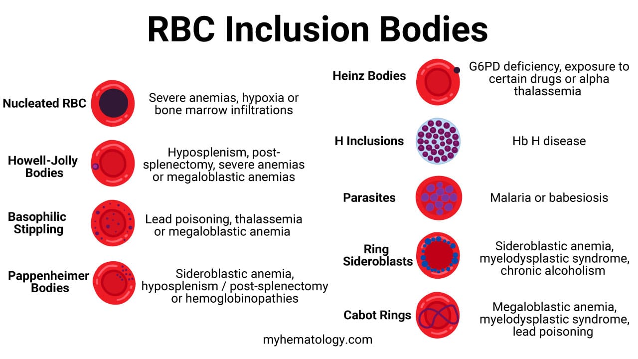 Red Blood Cell (RBC) Inclusion Bodies: Types and Causes