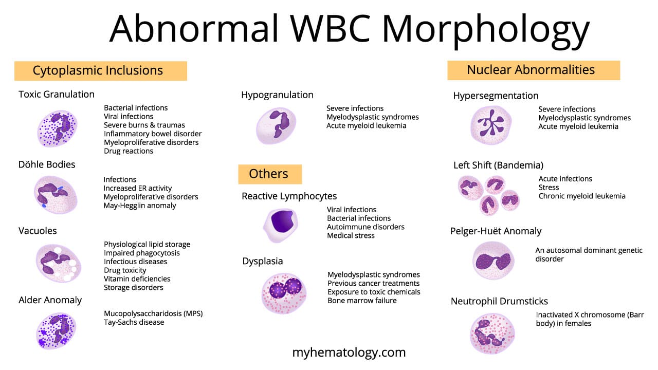Abnormal WBC Morphology: Description, Types and Causes