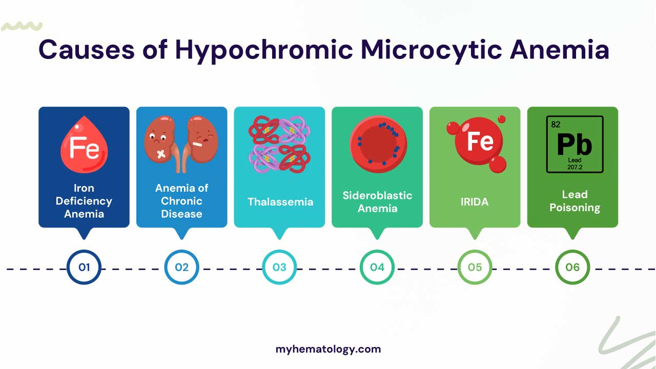Microcytic Anemia: Causes of Hypochromia and Microcytosis