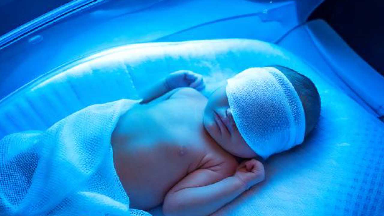 Neonatal Jaundice: Causes, Symptoms, Treatment & Complications