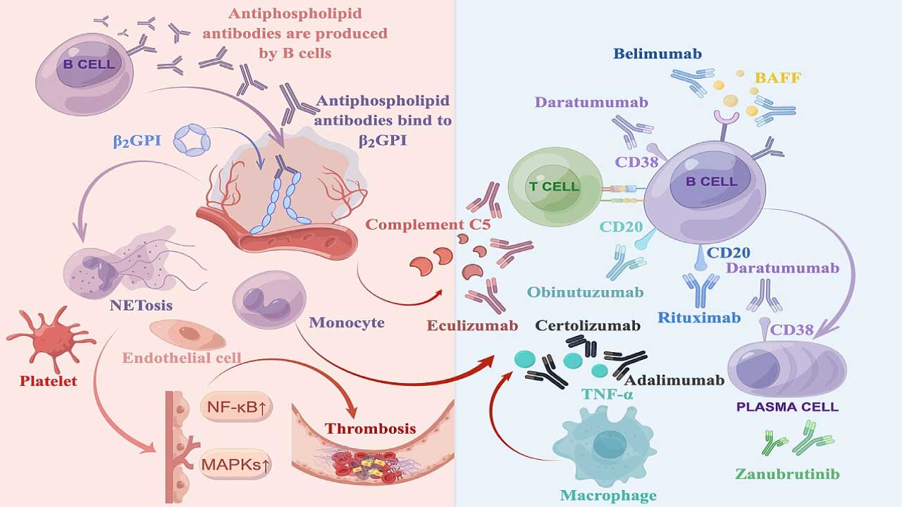 Antiphospholipid Syndrome: Classification, Diagnosis & Treatment