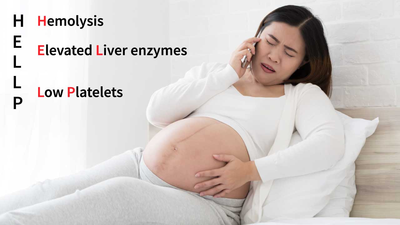 HELLP Syndrome: Pathophysiology, Symptoms & Treatment