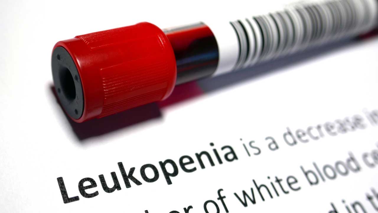 Leukopenia (Low White Cell Count): Causes, Symptoms & Treatment