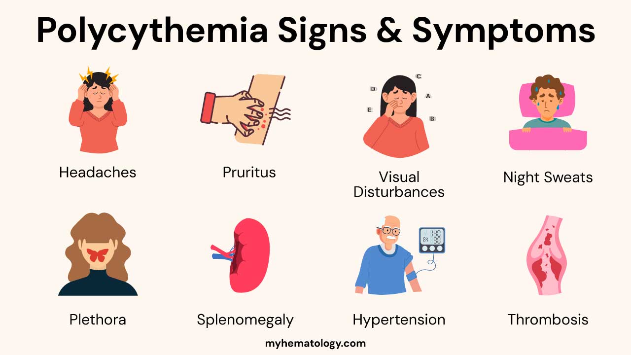 Polycythemia Vera: Causes, Pathophysiology, Symptoms & Treatment