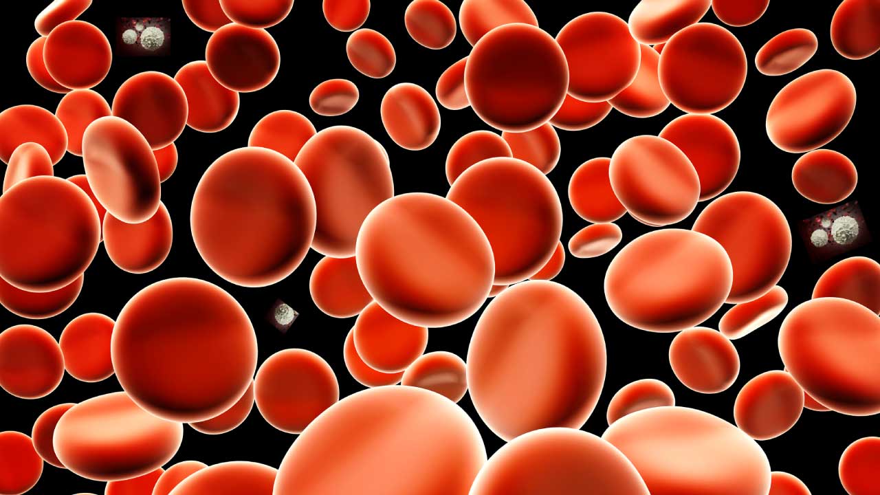 Polycythemia: Causes, Symptoms, Investigations & Treatment