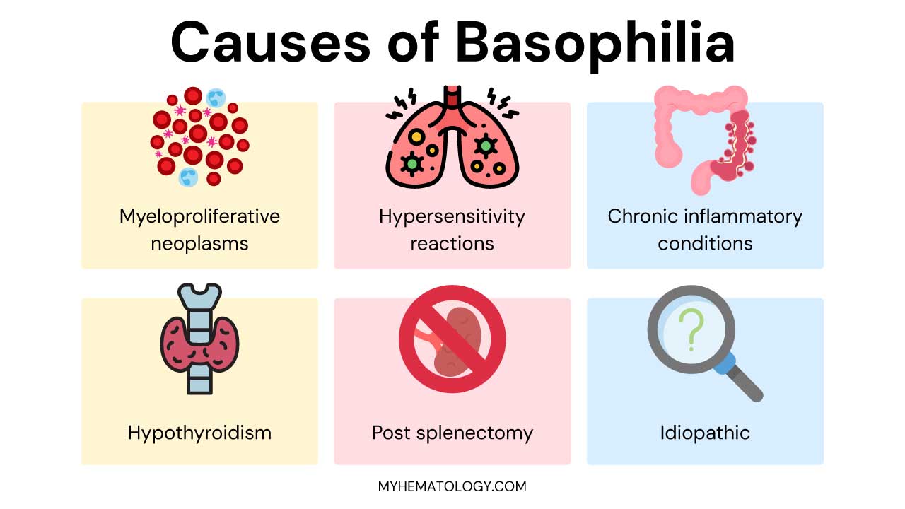 Basophilia (High Basophils): Symptoms, Causes & Diagnosis